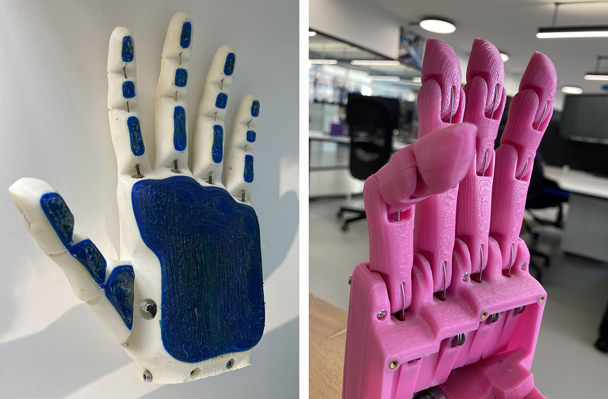 The Hero Arm: why children make great designers • V&A Blog